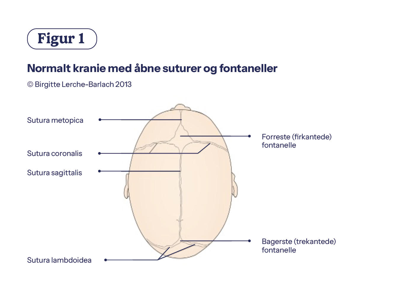 Medfødte kraniemisdannelser og vækstforstyrrelser - Fagligt selskab for ...